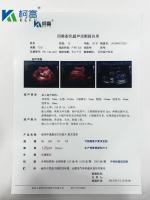China Inkjet Transparent Medical Dry Film PET X-Ray for CT DR MRI 100 Sheets per Box for sale