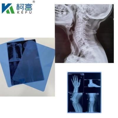 China Medical X Ray Film Dry Blue Inkjet Film A4 8x10 Sheet Roll 210 Microns for CT DR Imaging for sale