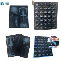China Medical Dry Inkjet X-Ray Imaging Film 8x10 inch High Resolution for Diagnostic Imaging for sale
