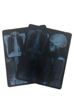 China Medical X Ray Dry Film 200±5μm High Sharpness PET Base Protective Layer 320dpi for sale