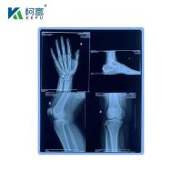 China High Sharpness Medical X Ray Film PET Base 200μm 320dpi for Fuji Printers for sale