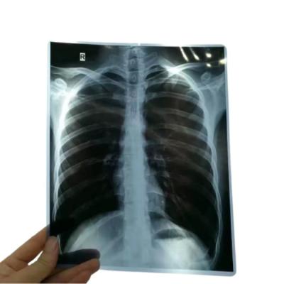 China Customized 8x10 Inch Medical Dry X-Ray Film for Inkjet Printers 175 Micron Base for sale