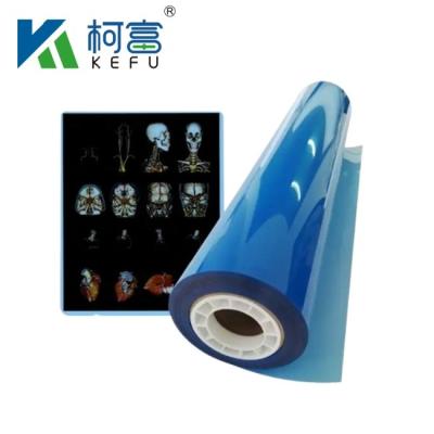 China Custom Blue White Inkjet Medical X Ray Film 210 Micron for Inkjet Printers for sale