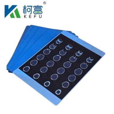 China Medical Image Dry PET Inkjet Blue Film for Fuji 2000 Lite 3500 Printers 210 Micron for sale