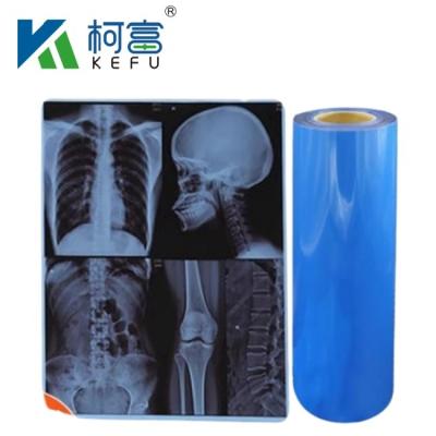 China Waterproof Medical X-Ray Thermal Film Blue 210 Microns for Inkjet Printers for sale
