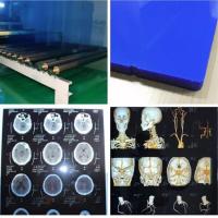 China Waterproof Medical X-Ray Thermal Film Blue 210 Microns for Inkjet Printers for sale
