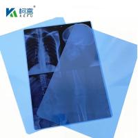 China Blue White PET Medical Film for X-Ray CT MRI DR Printers 14x17 100 Sheets for sale