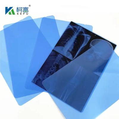 China High Resolution Blue Medical Laser Film 14x17 inch for Hospital CT MRI Printing Equipment for sale