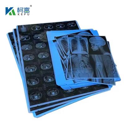 China Blue PET Based Laser X Ray Film 8x10 to 14x17 for Medical Imaging Thermal Print for sale