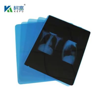 China Medical Laser X Ray Film Blue 8x10 to 14x17 Sizes Thermal Print Process for sale