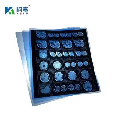 China Blue White Transparent Laser X Ray Film 8x10 to 14x17 Medical Imaging Film for sale