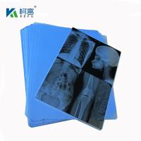 China Laser X Ray Film Blue 14x17 100 Sheets Medical Imaging Film for Radiological Diagnosis for sale