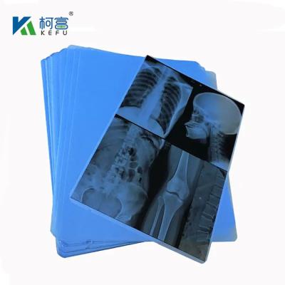 China Laser X Ray Film Blue 14x17 100 Sheets Medical Imaging Film for Radiological Diagnosis for sale