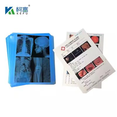 China Medical Blue Base Laser X Ray Film 8x10 to 14x17 Moisture Resistant Thermal Print for sale