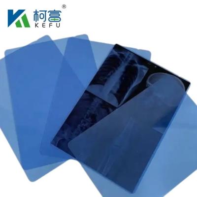 China Blue PET Based Medical X Ray Dry Film 200 Micrometers Thickness for Hospitals and Clinics for sale