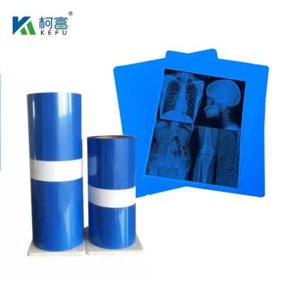 China Medical Dry Inkjet X-Ray Film 14x17 inch 35x43 cm for Kodak Fuji Agfa Printers for sale
