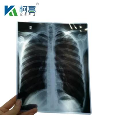 China Blue Medical X Ray Film 8x10 14x17 Inch for Fuji Printers 210 Micron Thickness for sale