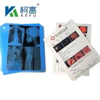 China 14x17 Inch Medical Dry X Ray Film High Quality Blue Thermal Film 200 Microns for Hospital Use for sale