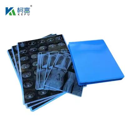 China Customized 8x10 Inch Medical Dry X-Ray Film for Inkjet Printers 100 Sheets per Box for sale