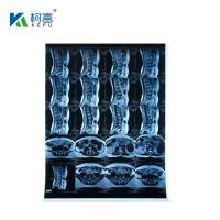 China Inkjet Medical X-Ray Blue Film 210micron CT DR Film A4 8x10 Sheet Roll for Medical Inkjet Printing for sale