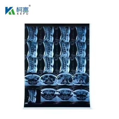 China Inkjet Medical X-Ray Blue Film 210micron CT DR Film A4 8x10 Sheet Roll for Medical Inkjet Printing for sale