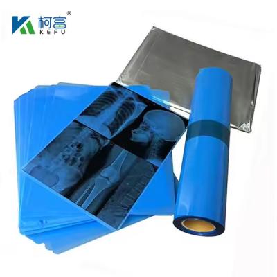 China High-Definition Medical X Ray Film 14x17 inch 35x43 cm for Accurate Imaging for sale