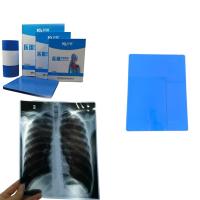 China A4 Size Blue Inkjet X Ray Film for Medical Image Printout CT CR DR MTR PET 100 Sheets for sale