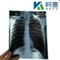 China Inkjet X Ray Film 8x10 Inches Polyester Blue Transparent for Medical Imaging Diagnosis for sale