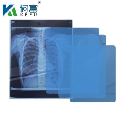 China Medical Dry DIHL Film Laser Xray Film 8x10 to 14x17 Inch for Fuji Printers for sale