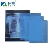 China High Definition Medical Imaging CT DR Inkjet X-ray Film 175mic 210mic Transparent Blue for sale