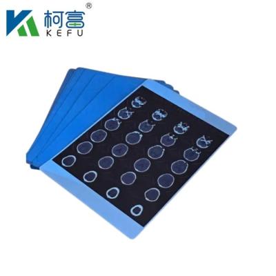 China Medical X-Ray CT DR Dry Scan Film 210 Microns for Laser Thermal Printers for sale