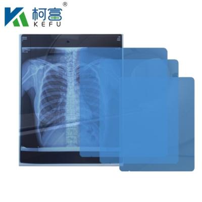 China Customized Size Blue Medical X Ray Film 210 Micron for Fuji Inkjet Printers for sale