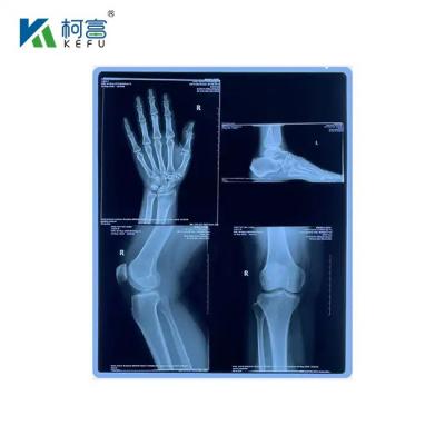 China Medical Laser Film 13x18in 0.14mm Blue for Radiological Imaging Thermal Print for sale