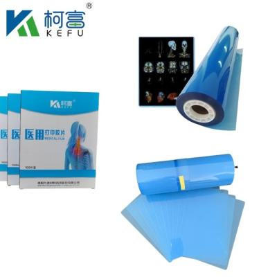 China Medical Inkjet Blue X-ray Film 210 Micron for CT MRI A3 A4 Dry Imaging for sale