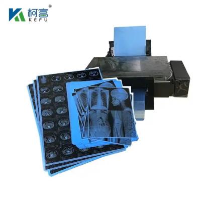 China Medical Grade Laser X Ray Film 16x20in 0.16mm High Definition for Multi Slice CT Scan for sale