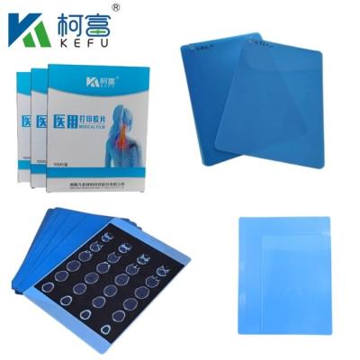 China Wholesale Medical Inkjet X-ray Film Blue 8x10 14x17 for Clinics Hospitals for sale