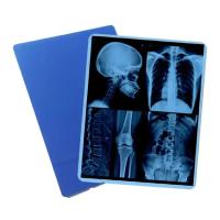 China 125 Micron Semi-Transparent White PET Medical X-Ray Film for Laser Imaging 14x17 inch for sale