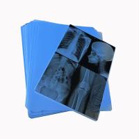 China Medical Blue X-Ray Film for Laser Printing 14x17 inch 35x43 cm High Resolution Dry Film for sale