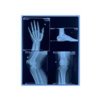 China 11x14 Medical Blue X Ray Film for Laser Printing 28x35cm 100 Sheets for sale