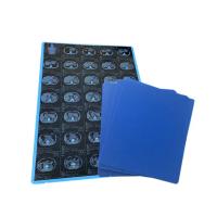 China 11x14 Medical Blue X Ray Film for Laser Printing 28x35cm 100 Sheets for sale