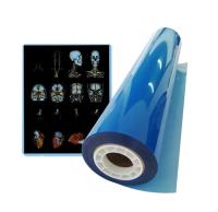 China 11x14 Medical Blue X Ray Film for Laser Printing 28x35cm 100 Sheets for sale