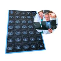 China 11x14 Medical Blue X Ray Film for Laser Printing 28x35cm 100 Sheets for sale