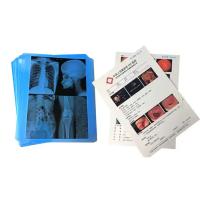 China Medical Blue X-Ray Film for Laser Printing 14x17 inch 100 Sheets per Box for sale