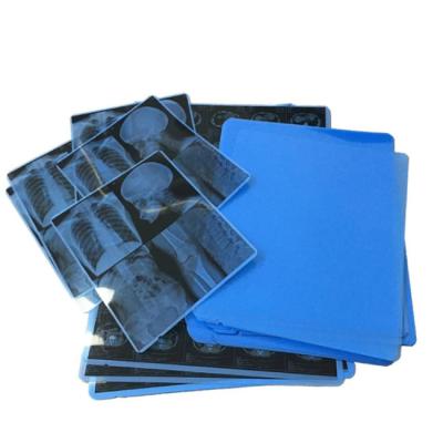 China Medical Blue X-Ray Film for Laser Printing 14x17 inch 100 Sheets per Box for sale