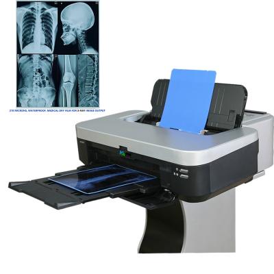 China Inkjet X Ray Film Roll 17 inch 100 Sheets 1-3 Min Printing Speed for Medical Imaging for sale