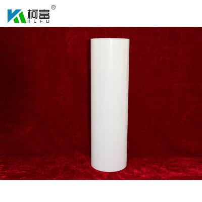 China Inkjet X Ray Film 14x17 100 Sheets Roll Low Fog High Resolution 9600x2400 dpi for Medical Imaging for sale