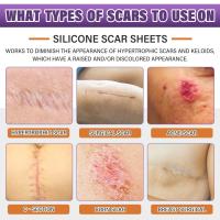 China Wholesale Silicone Scar Sheets | Factory Grade Medical Silicone Scar Tape for sale