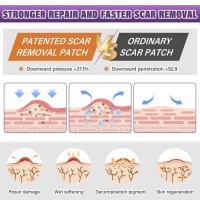 China Wholesale Silicone Scar Sheets | Factory Grade Medical Silicone Scar Tape for sale