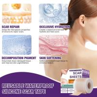 China Wholesale Silicone Scar Sheets | Factory Grade Medical Silicone Scar Tape for sale