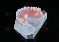 China TCS Flexible Partial Stain Resistant BPA Free Partial Dentures For Natural Look for sale